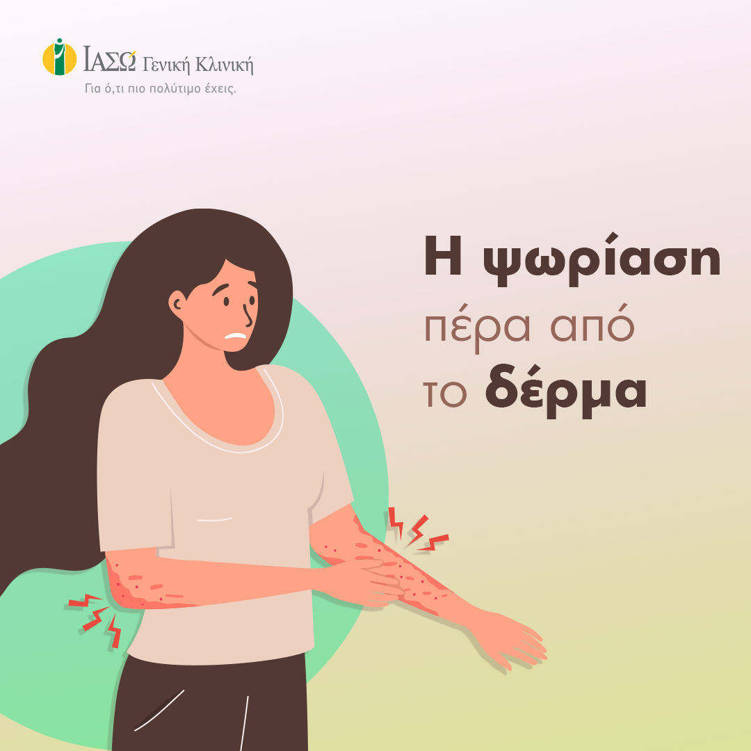 Η Ψωρίαση πέρα από το δέρμα
