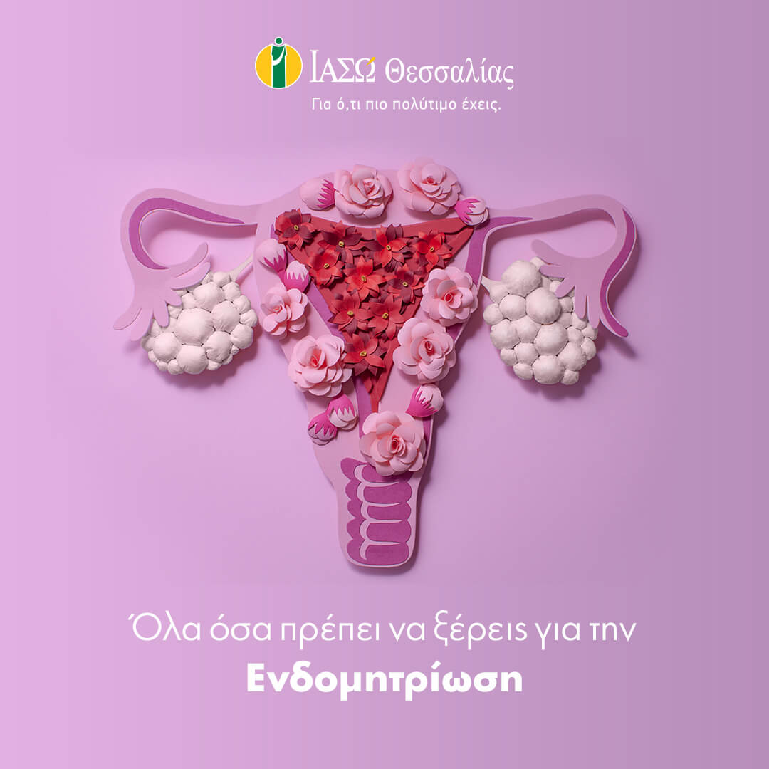 Ενδομητρίωση: Τι είναι, πως προκαλείται & πως αντιμετωπίζεται