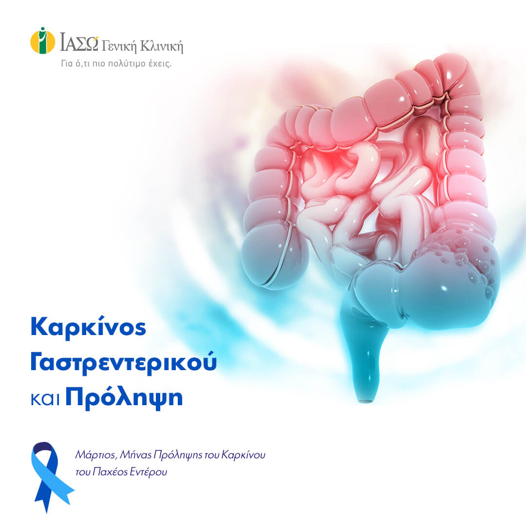Προληπτικός Έλεγχος για Καρκίνο Γαστρεντερικού