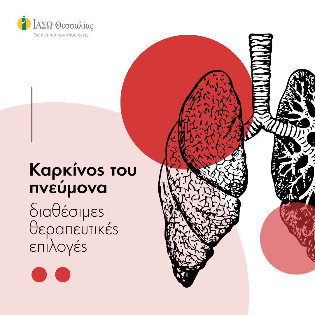 Καρκίνος του Πνεύμονα – Τα στάδια και η θεραπεία